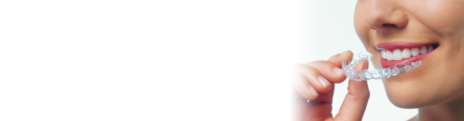 New Year, New You! Join Us for an Invisalign Special Event